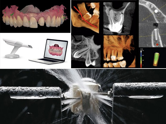 New Dental Tech in Waukee, IA - Lush Family Dental